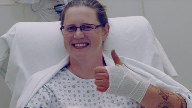Patient Gives ‘Thumbs Up’ for Wide Awake Hand Surgery - UConn Today