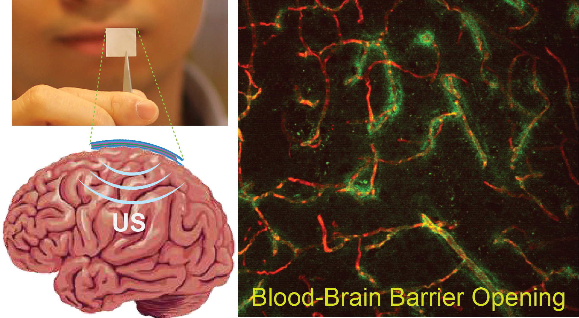 Buzzing Through the Blood-Brain Barrier - UConn Today