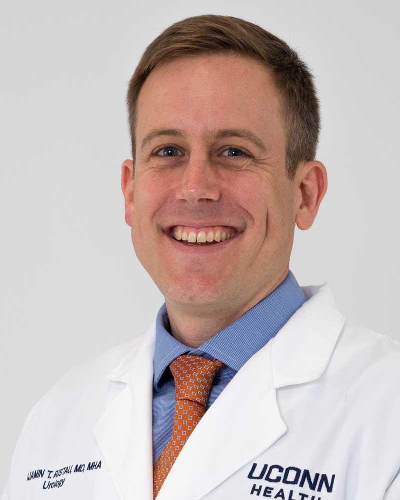 Nuances of Prostate Cancer Detection - UConn Today