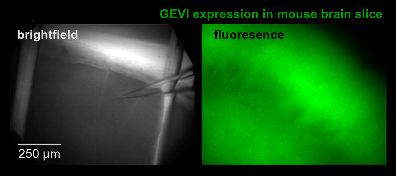 Testing the Fluorescent Proteins That Light Up the Brain - UConn Today