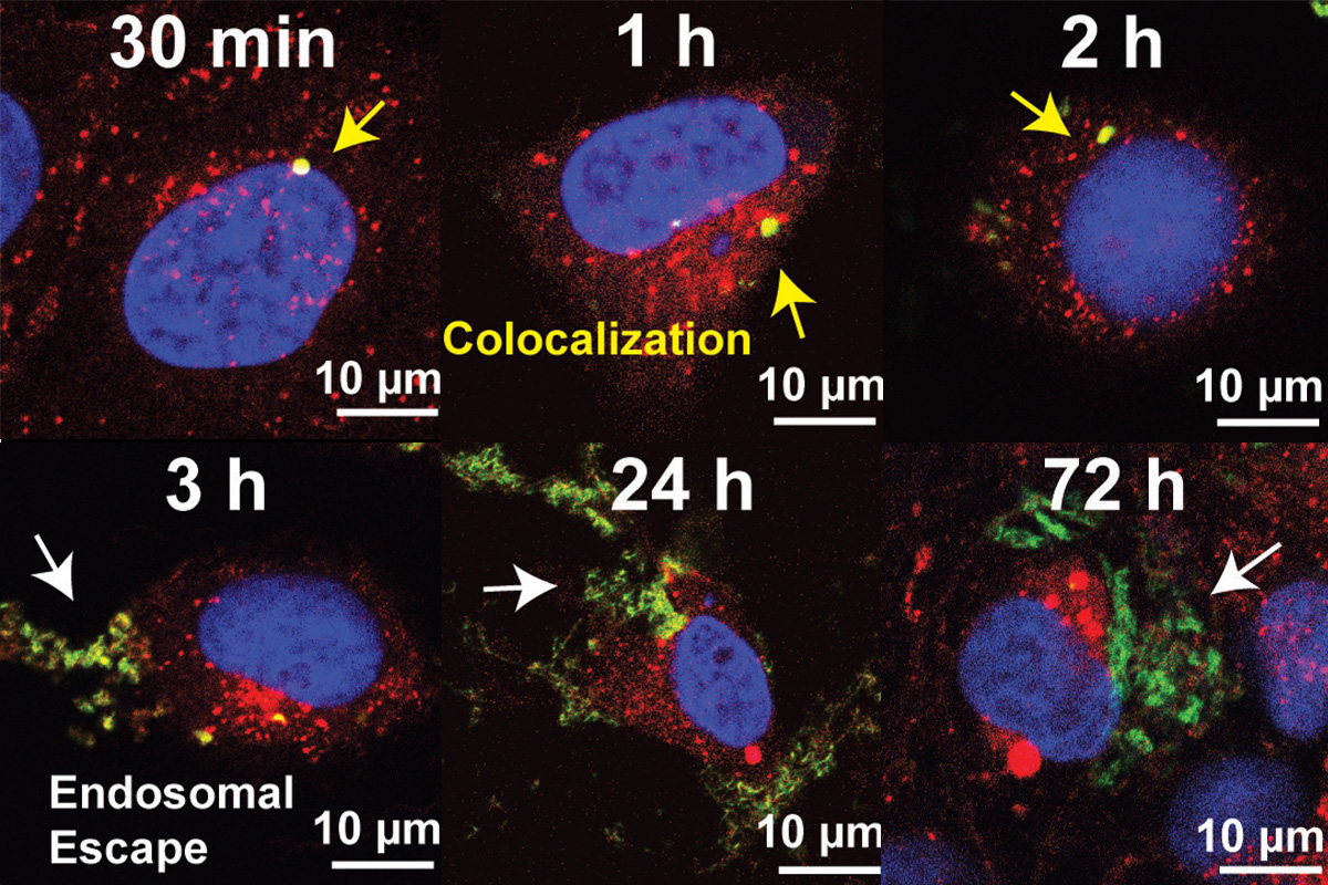 Escape From the Endosome! - UConn Today