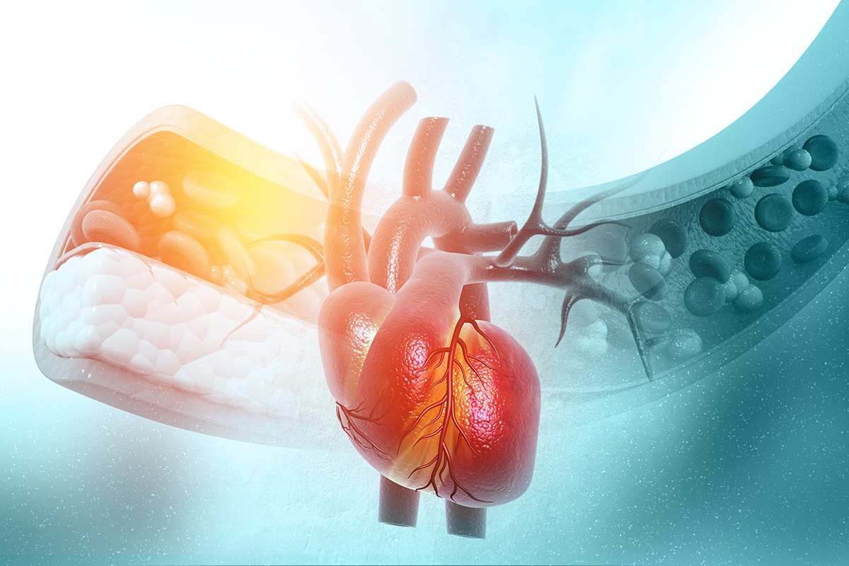 UConn Health Cardiologist: ‘Everyone’ Needs to Know Their Cholesterol ...