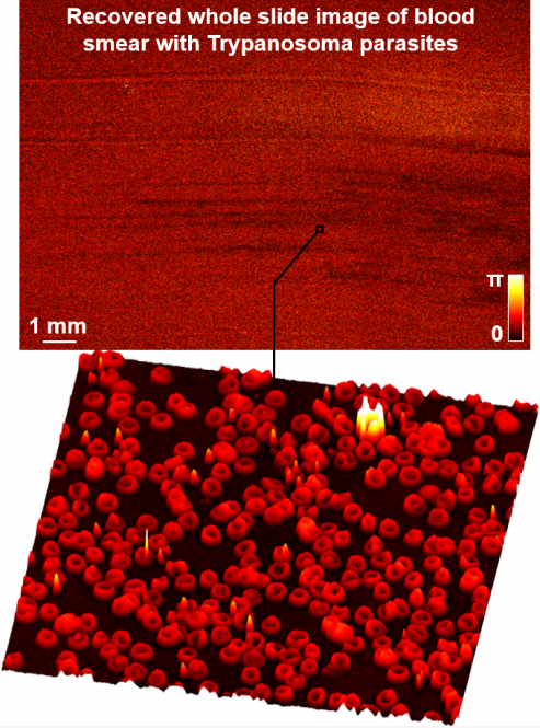 Blood-cell Lens Enables High-Quality Imaging with Blu-ray Technology ...