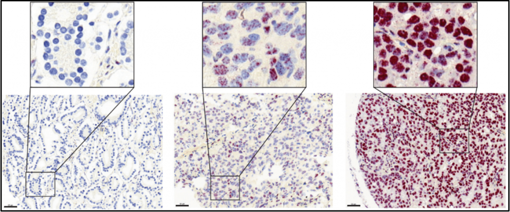 A Potential Milestone in Cancer Therapy - UConn Today