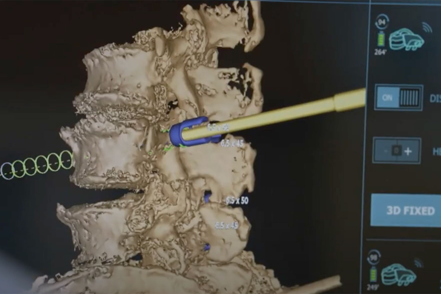 Dr. Hilary Onyiuke Among ‘Elite 8’ in Augmented Reality Spine Surgery ...
